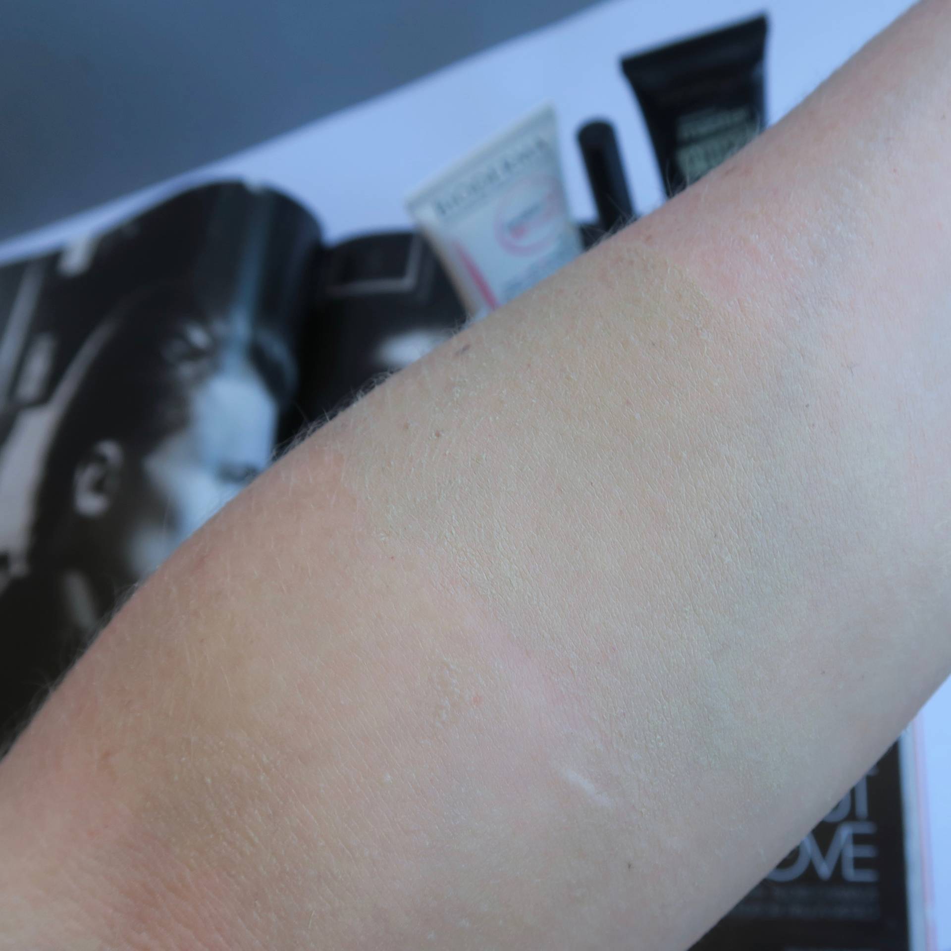 Rosacea Cover Ups For Men & Those Who Prefer Light Coverage