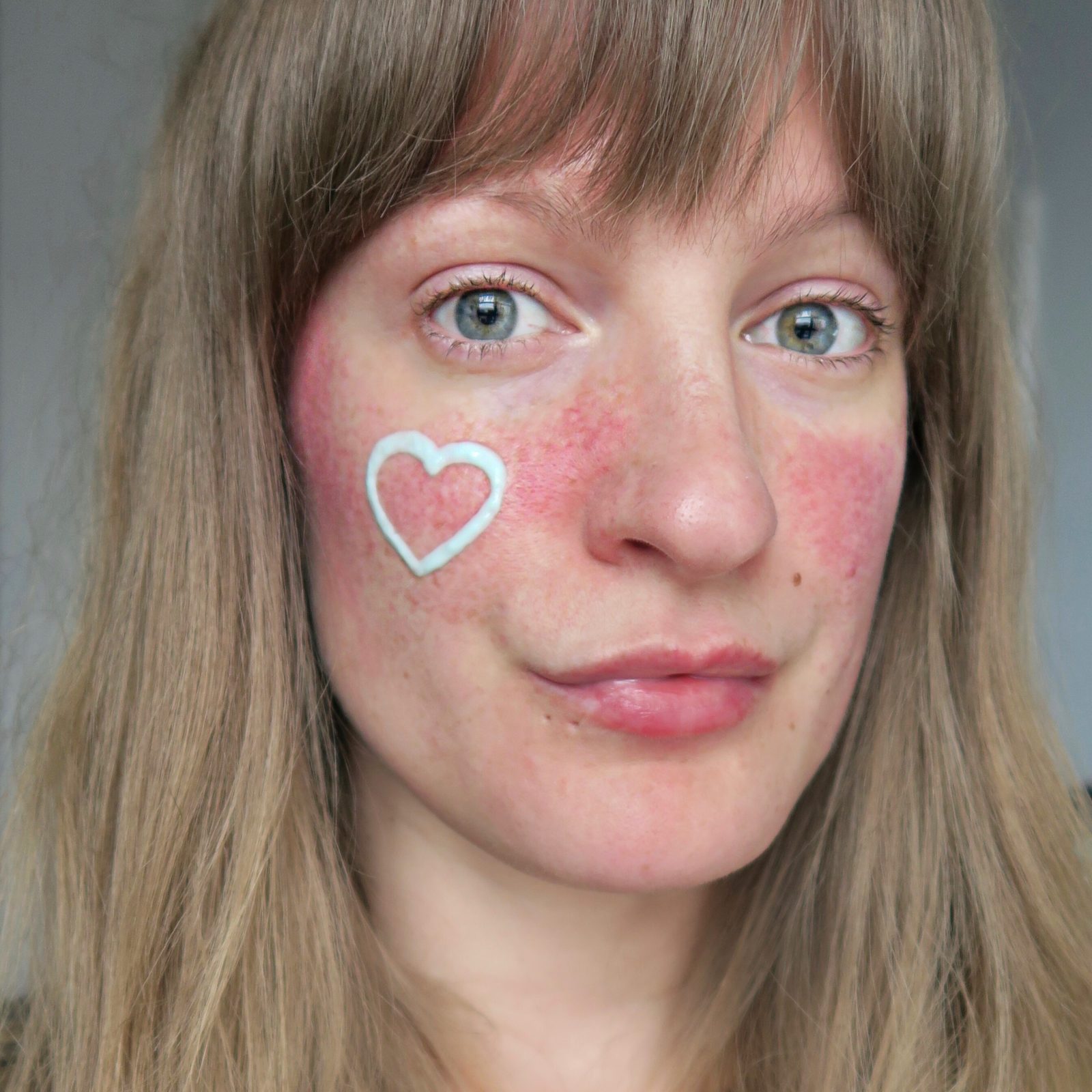 My Rosacea Story With Eau Thermale Avène - AD